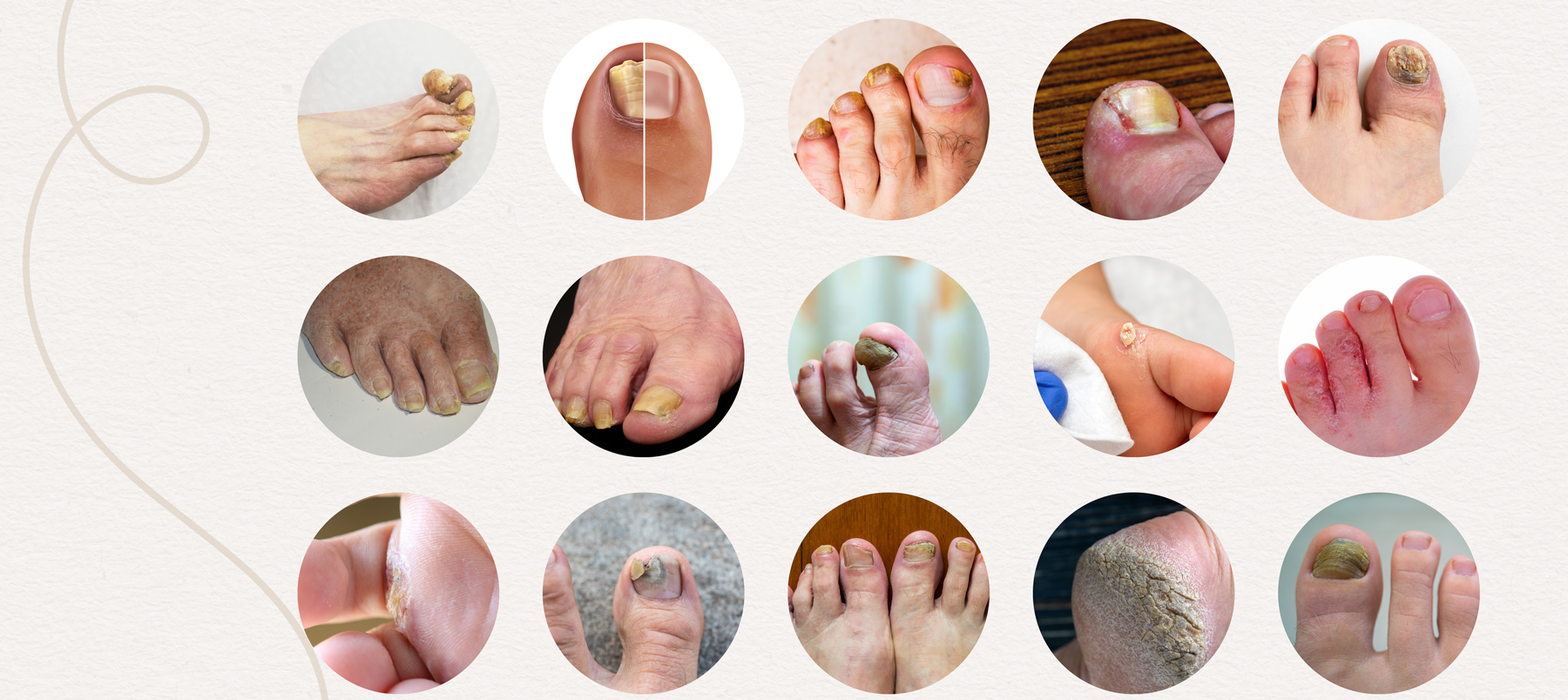Foot Care Treatment Services | Pro Foot Care